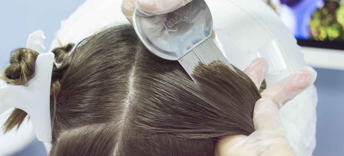 Las liendres. Qué son y por qué aparecen - ¡Help! Piojitos