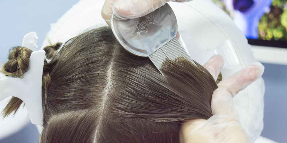 Las liendres. Qué son y por qué aparecen - ¡Help! Piojitos